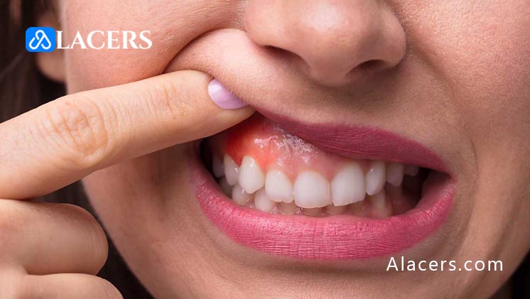 What Does Mouth Cancer Look Like? Powerful Warning Signs